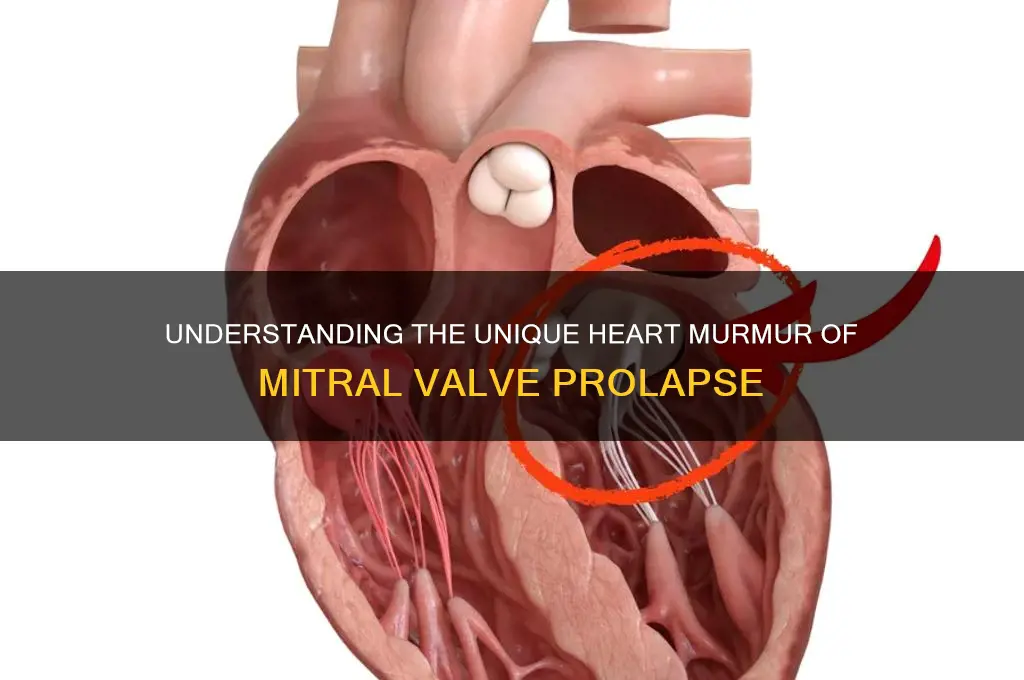 Understanding The Unique Heart Murmur Of Mitral Valve Prolapse | SoundCy