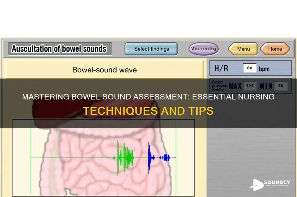 Mastering Bowel Sound Assessment: Essential Nursing Techniques And Tips ...