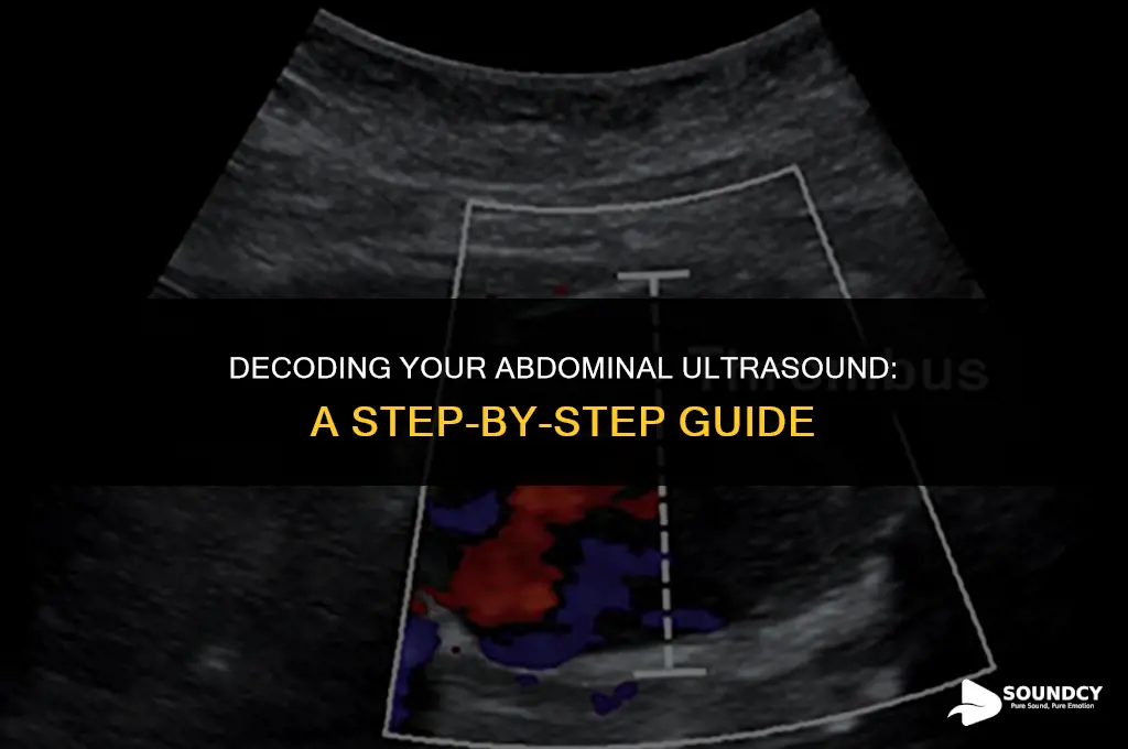 Decoding Your Abdominal Ultrasound: A Step-By-Step Guide | SoundCy