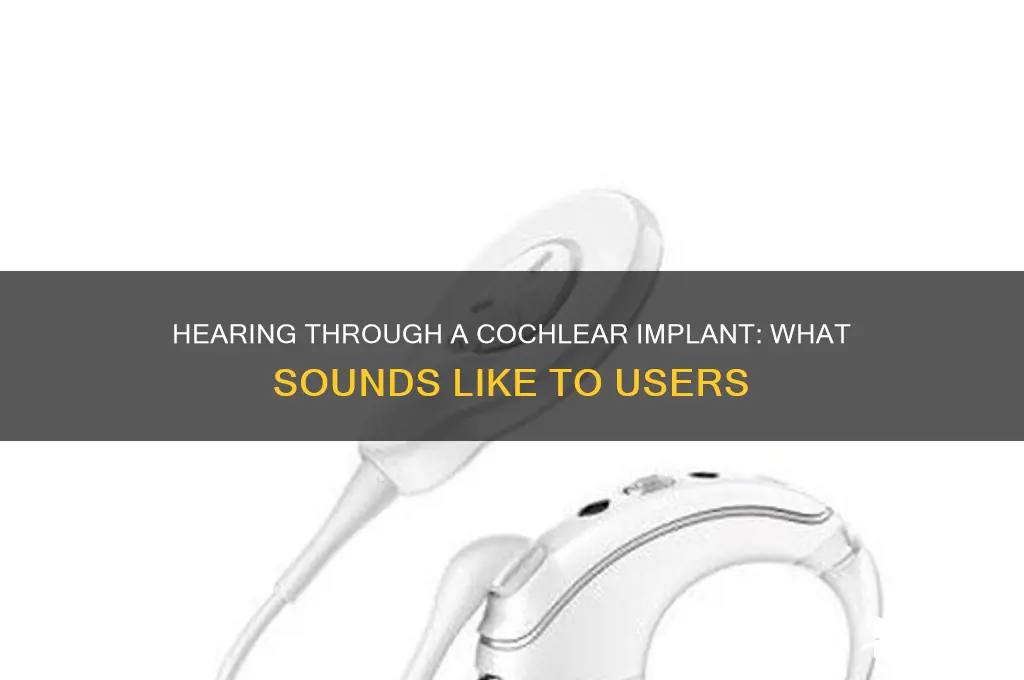 Hearing Through A Cochlear Implant: What Sounds Like To Users | SoundCy