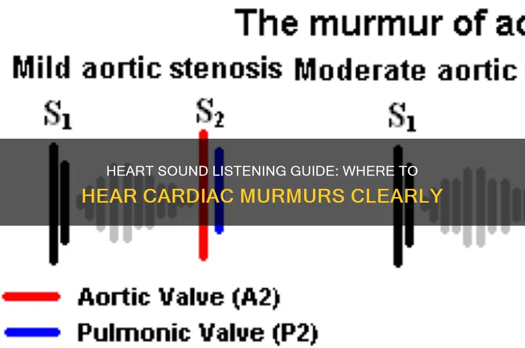 Heart Sound Listening Guide: Where To Hear Cardiac Murmurs Clearly ...