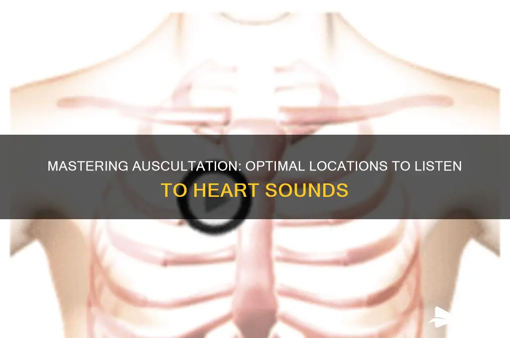 Mastering Auscultation: Optimal Locations To Listen To Heart Sounds ...